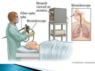 BRONCHOSCOPY | PPTX