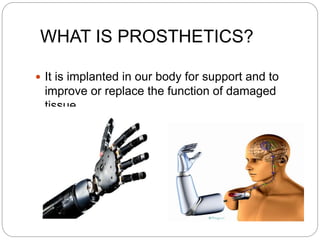 BRAIN PROSTHETICS | PPT