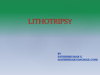 LITHOTRIPSY | PPTX