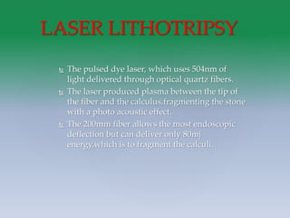 LITHOTRIPSY | PPTX