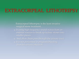 LITHOTRIPSY | PPTX