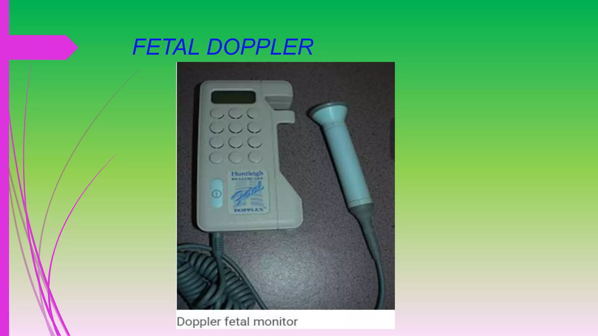 FETAL DOPPLER | PPTX