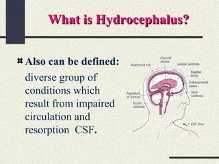Hydrocephalus | PPT