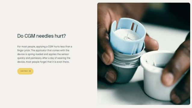 Wearing a CGM — Where Does it Go? | PPTX