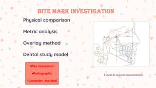 Bite mark analysis | PPTX