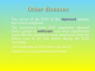 ELECTRO OCULOGRAPHY | PPT