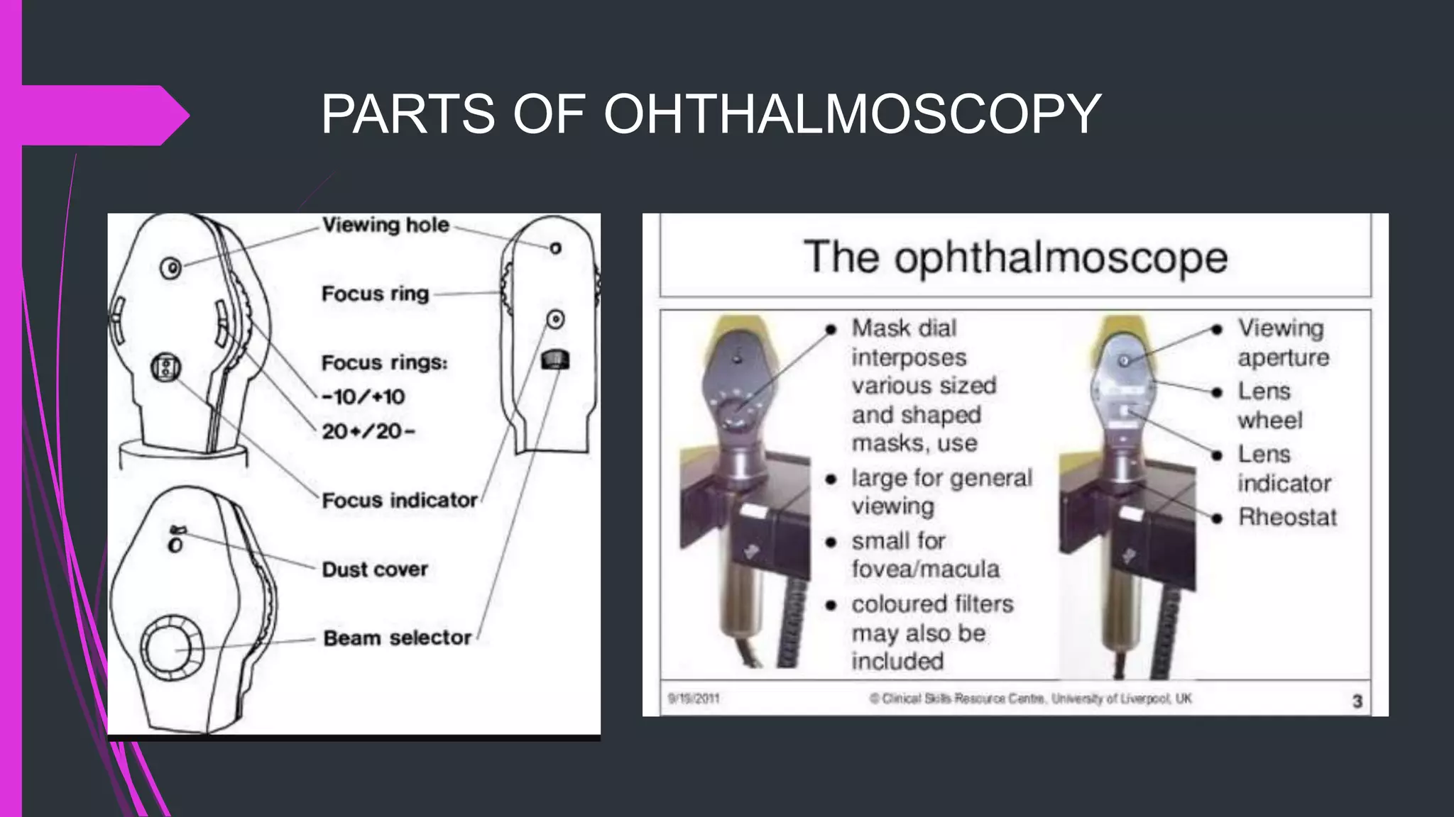 OPHTHALMOSCOPY | PPTX
