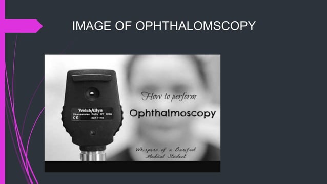 OPHTHALMOSCOPY | PPTX | Eye and Vision Conditions | Diseases and Conditions
