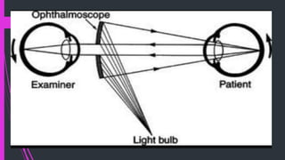 OPHTHALMOSCOPY | PPTX