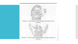 Airway Management | PPTX
