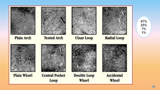 Dermatoglyphics | PPTX