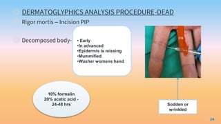 Dermatoglyphics | PPTX