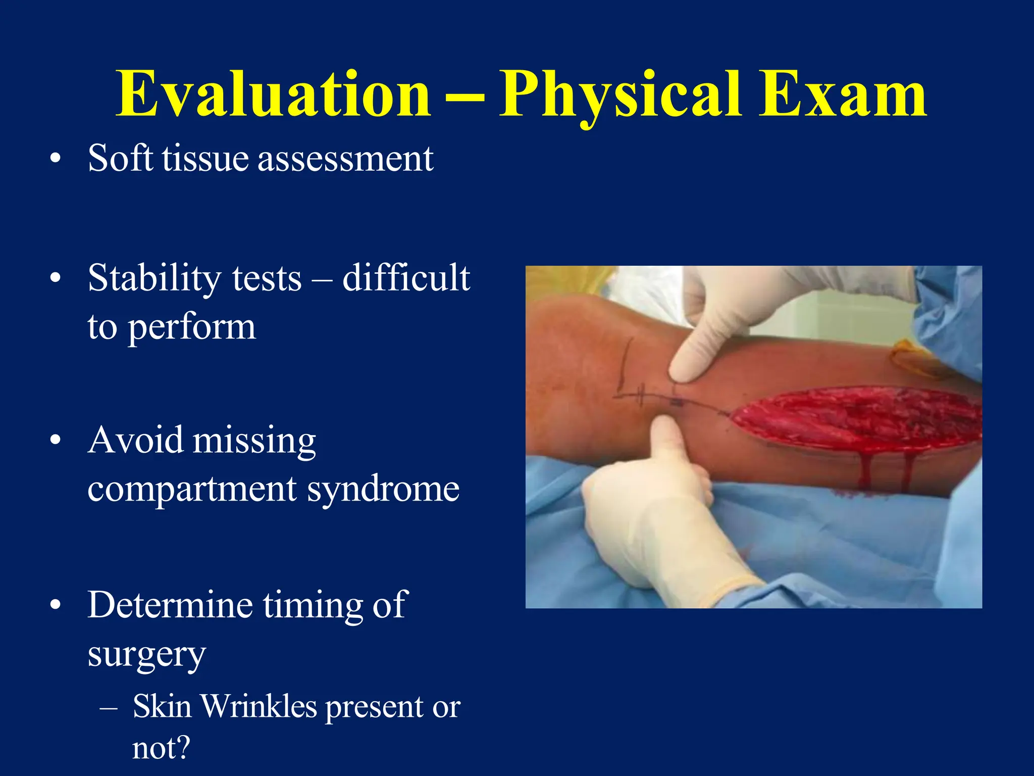 Proximal Tibia Fractures and Its Management.pptx