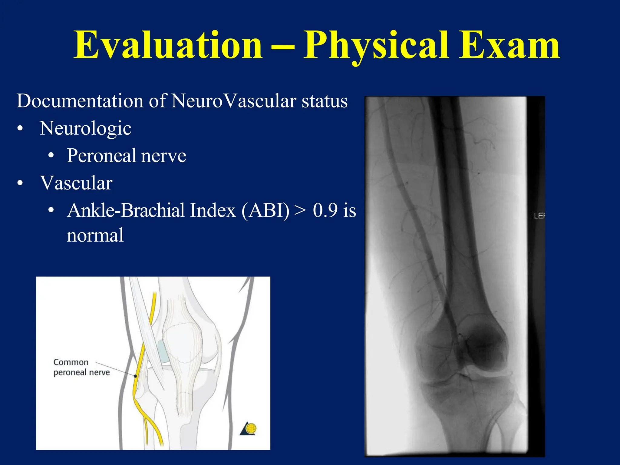 Proximal Tibia Fractures and Its Management.pptx