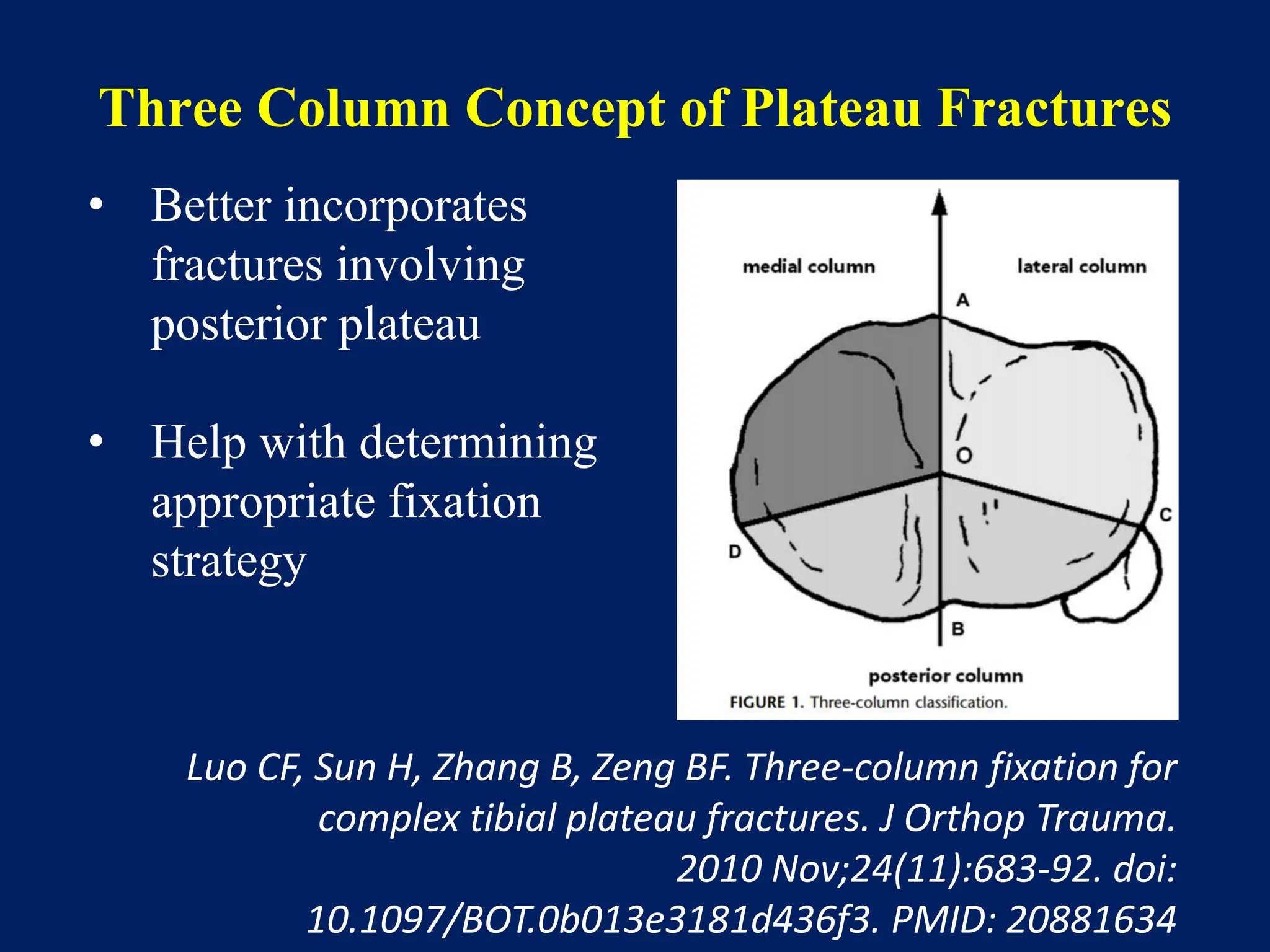 Proximal Tibia Fractures and Its Management.pptx