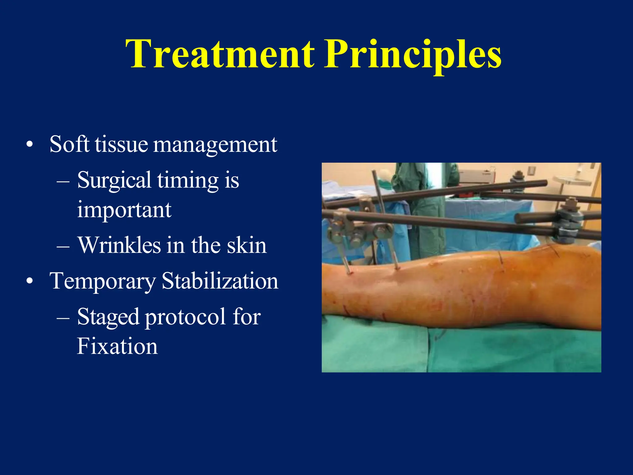 Proximal Tibia Fractures and Its Management.pptx