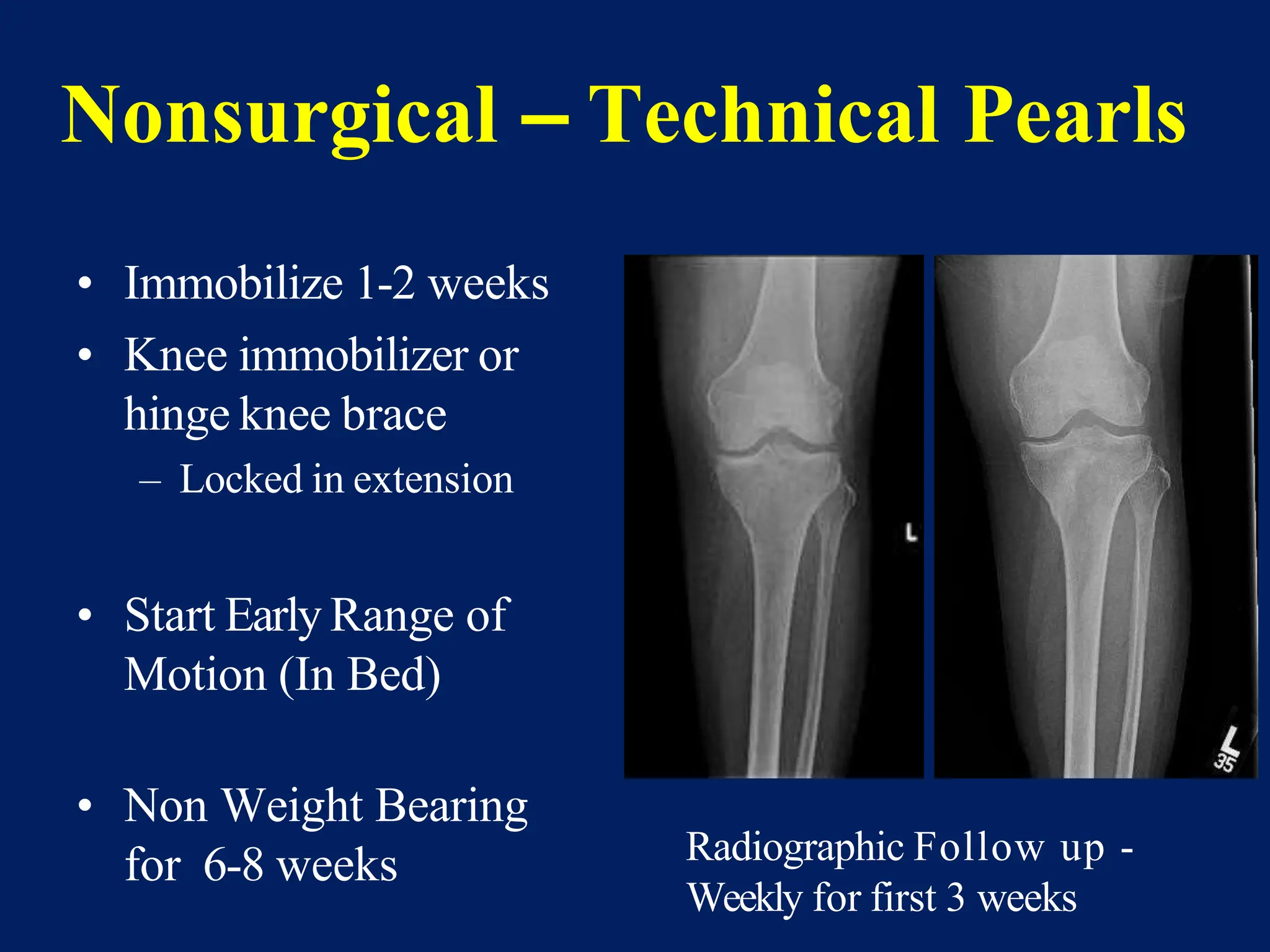 Proximal Tibia Fractures and Its Management.pptx