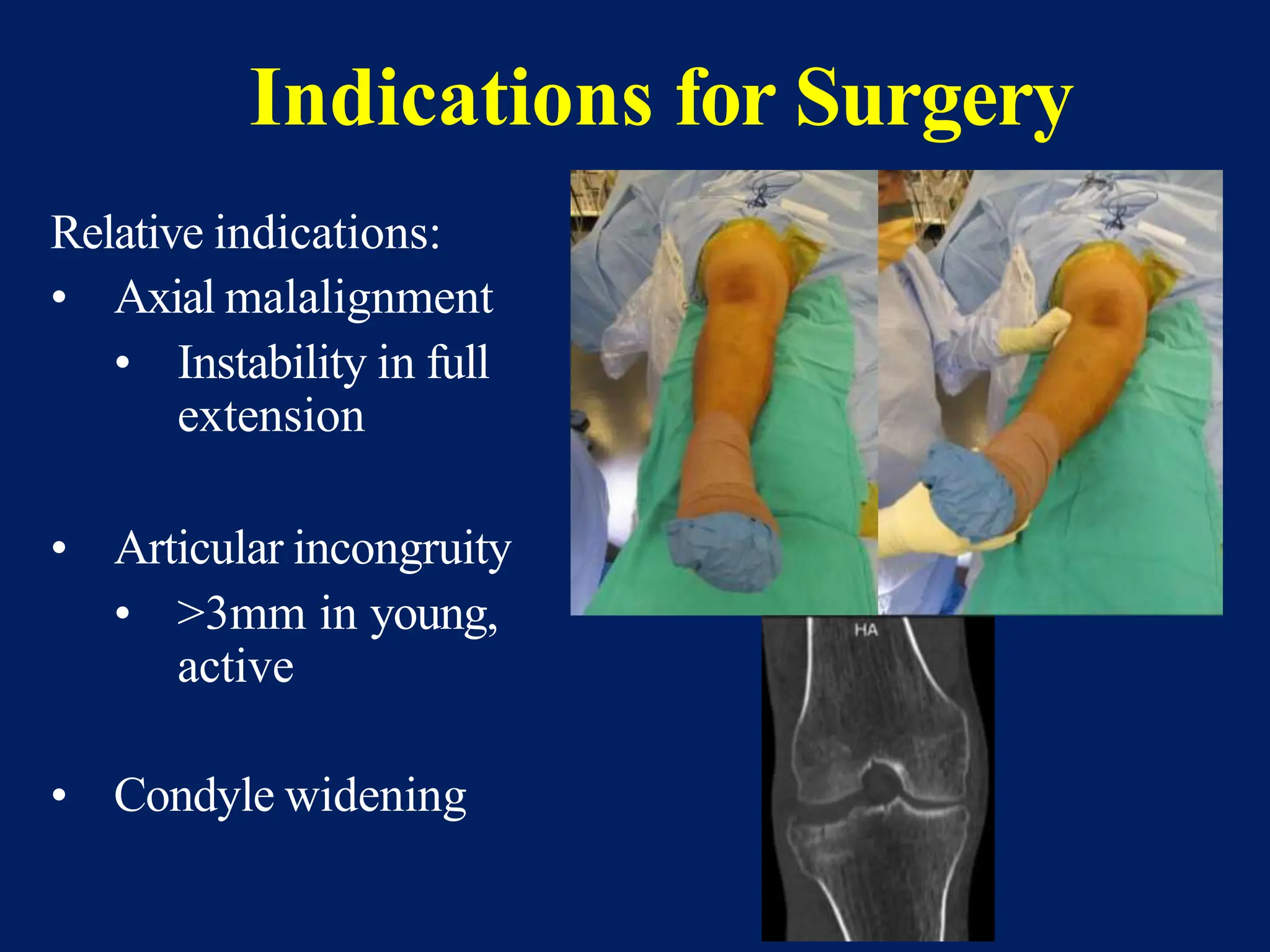 Proximal Tibia Fractures And Its Management Pptx
