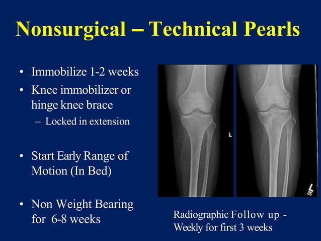 Proximal Tibia Fractures And Its Management Pptx
