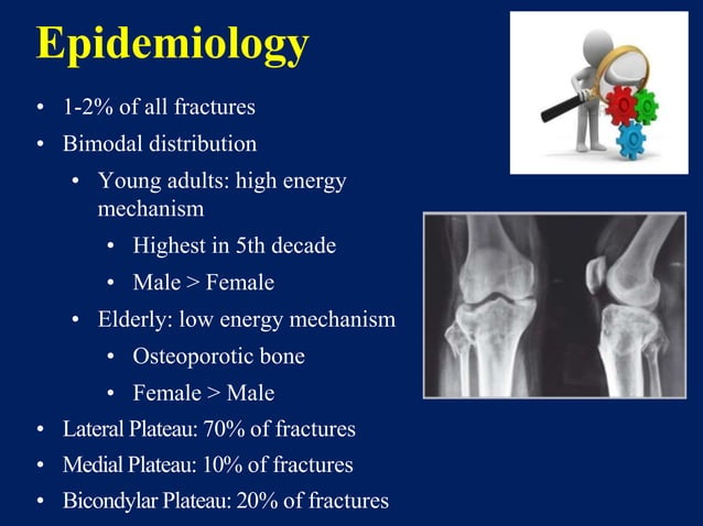 Proximal Tibia Fractures and Its Management.pptx