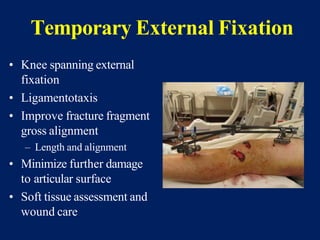 Proximal Tibia Fractures and Its Management.pptx