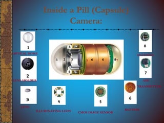 BIOMEDICAL INSTRUMENTATION PILL CAMERA | PPT | Digestive Disorders ...
