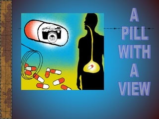 BIOMEDICAL INSTRUMENTATION PILL CAMERA | PPT | Digestive Disorders ...