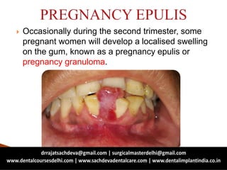 Pregnancy affecting Oral health | Risk to Oral Health in Pregnancy | PPTX