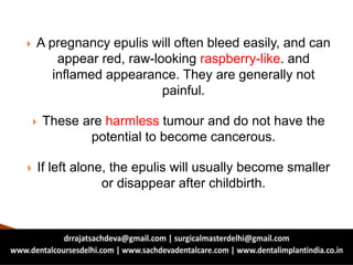 Pregnancy affecting Oral health | Risk to Oral Health in Pregnancy | PPTX