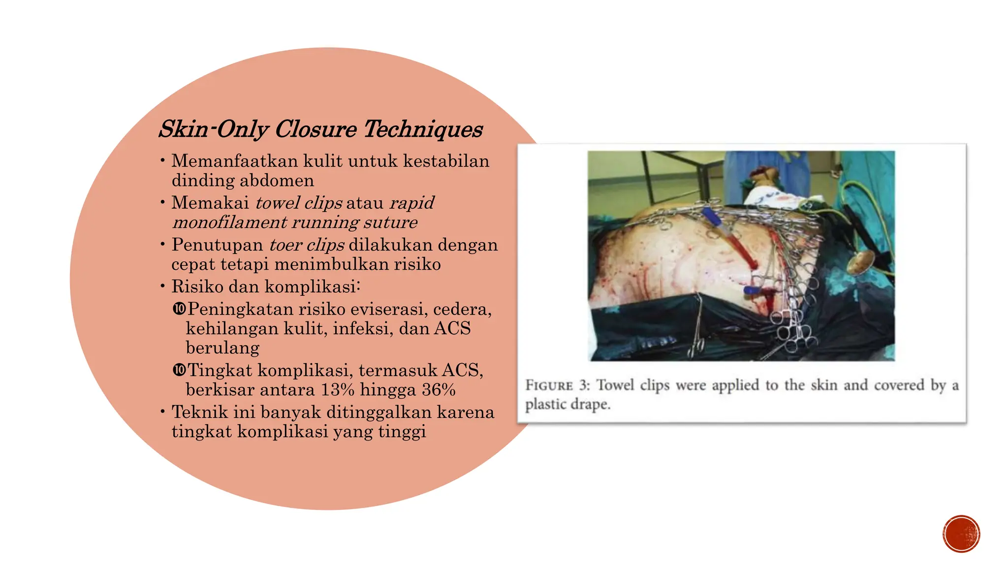 ppt abdominal wall closure indo fix oke.pptx