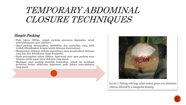 ppt abdominal wall closure indo fix oke.pptx