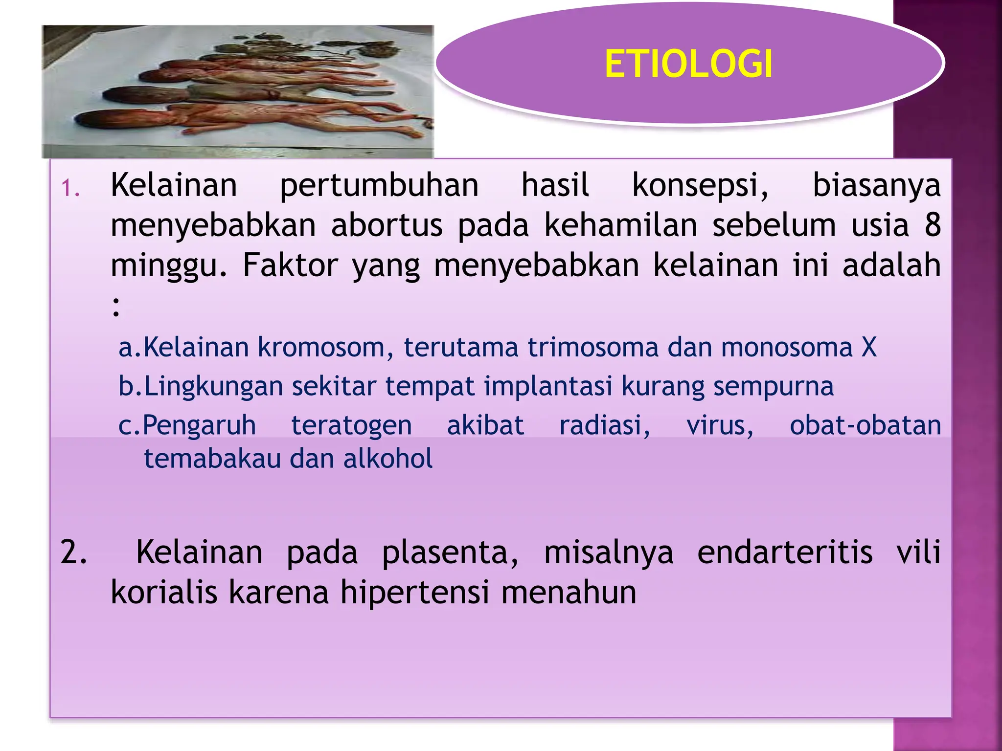 PPT MATA KULIAH KEBIDANAN TENTANG ABORTUS.pptx