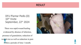 PPT ABSTRACT DFU SUNANDAR FATWA (1).pptx