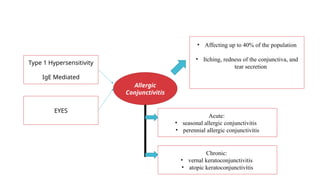 PPT Allergic conj.pptx power point tugas | PPTX