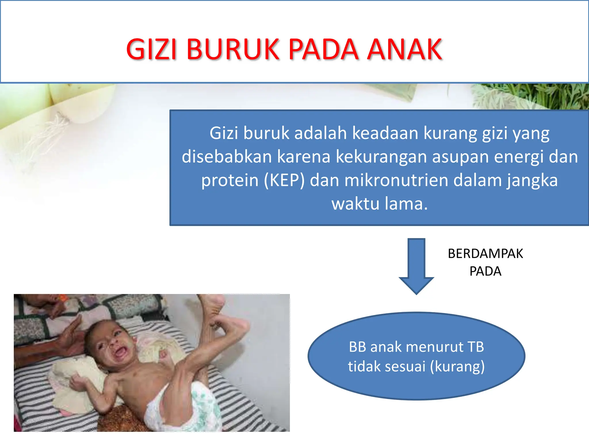PPT PENYEBAB ANAK GIZI BURUK - Salin.pptx