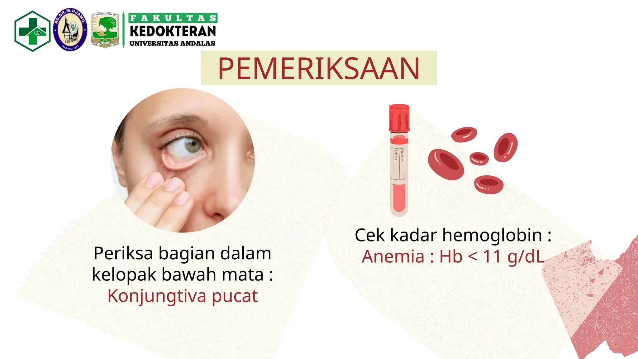 PPT Anemia Pada Ibu Hamil fix banget.pptx