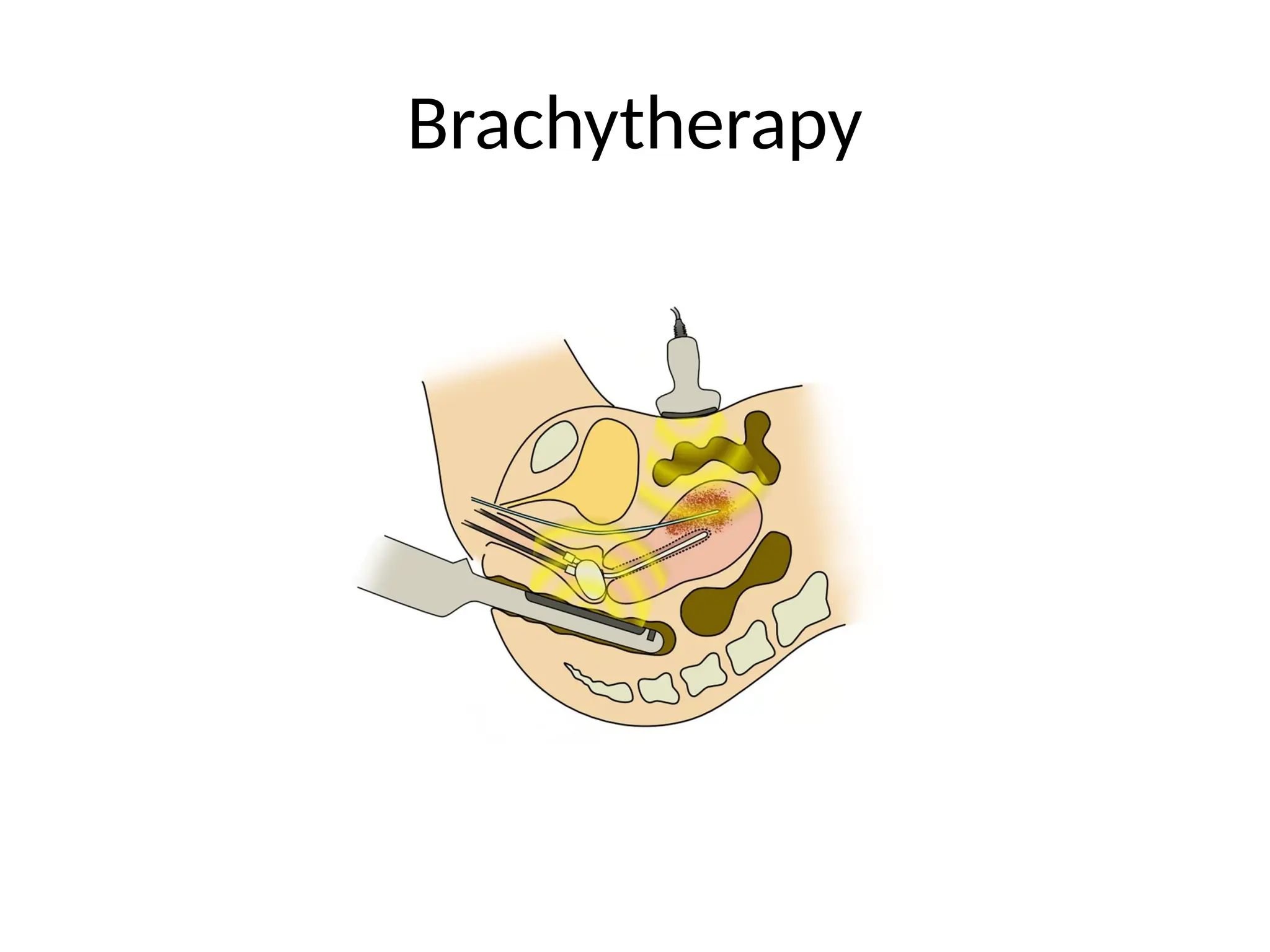 Principles of Oncology and the basics of Oncology.pptx Principles of Oncology and the basics of Oncology.pptx
