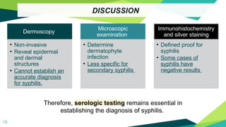 annular secondary syphilis a case report | PPT