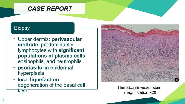 annular secondary syphilis a case report | PPTX