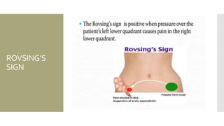 PPT_APPENDICITIS_GI.pptx