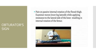 PPT_APPENDICITIS_GI.pptx