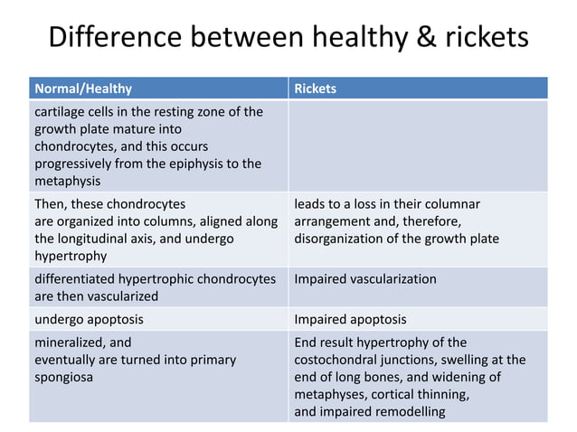 Ppt Approach to Rickets and it's Management | PPTX