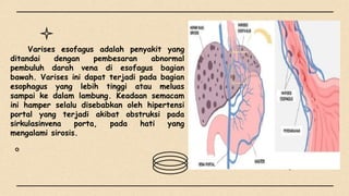 ppt askep varises esophagus baru bab 2.pptx