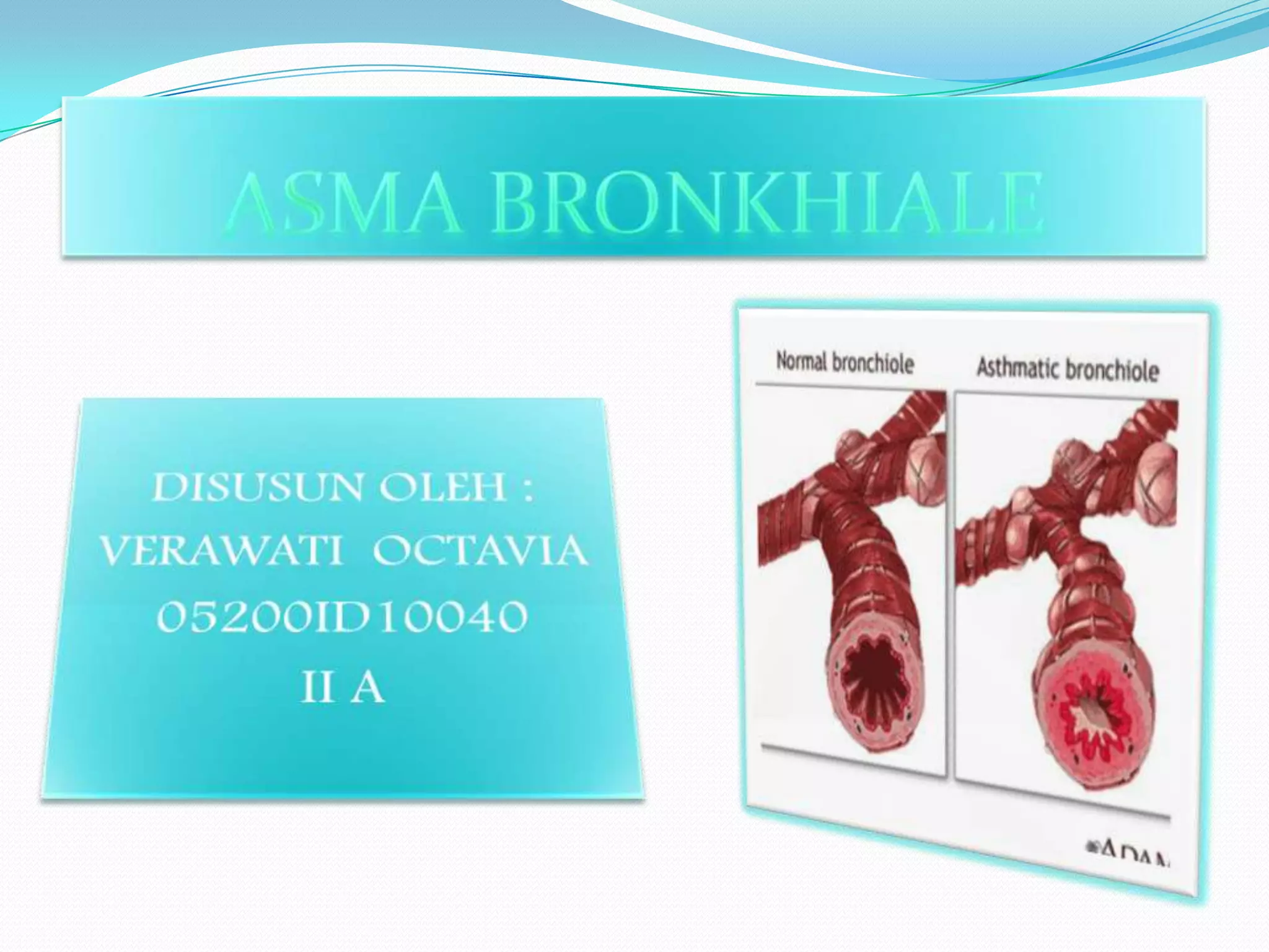 Ppt Asma Bronkhiale | PPTX