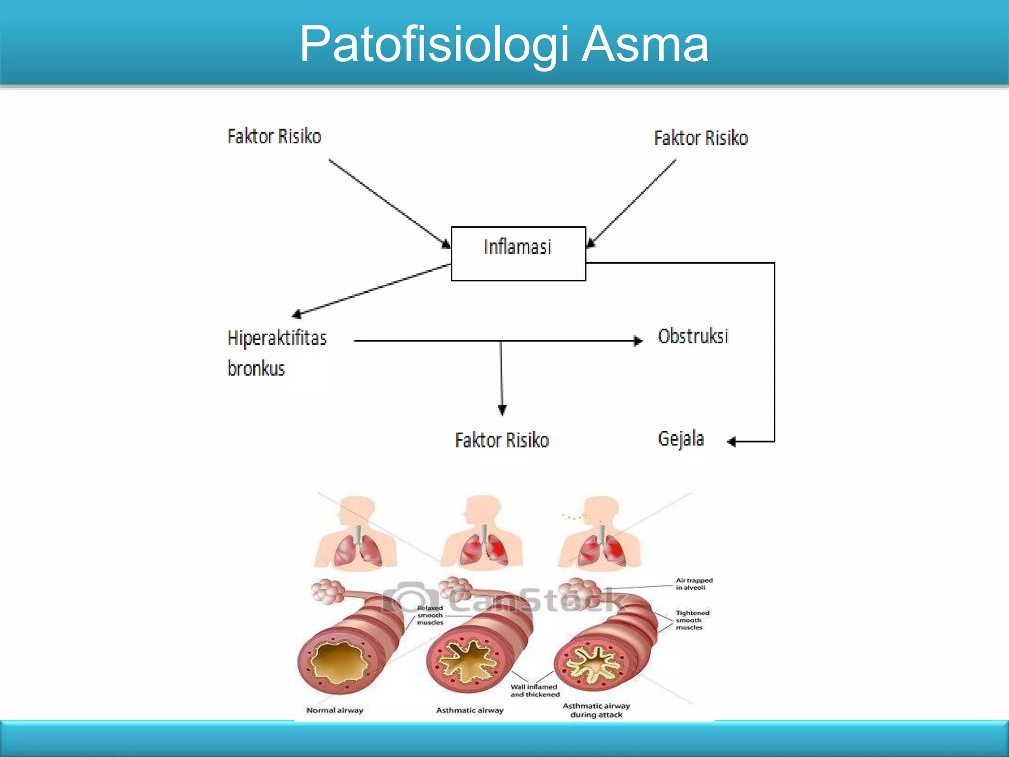 Ppt Penyakit Asma | PPTX