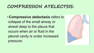 Ppt atelectasis | PPTX | Lung and Respiratory Health | Diseases and ...