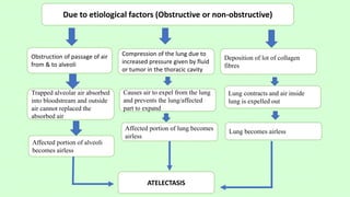 Ppt atelectasis | PPTX