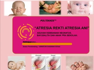 Atresia Rekti Atresia Ani | PPTX