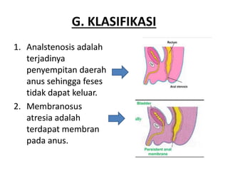Atresia Rekti Atresia Ani | PPTX