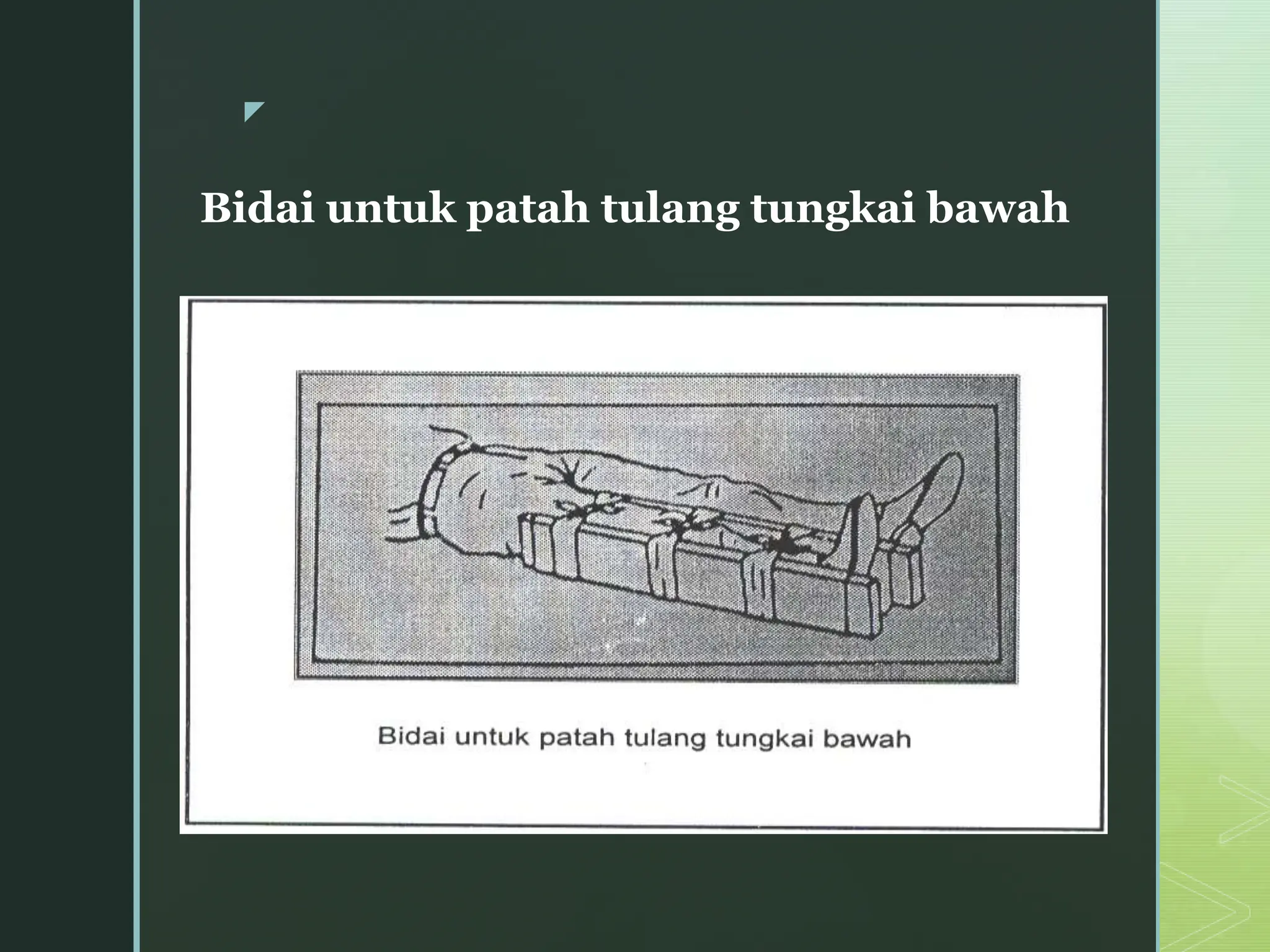 Presentasi alat kesehatan serta BIDAI.ppt